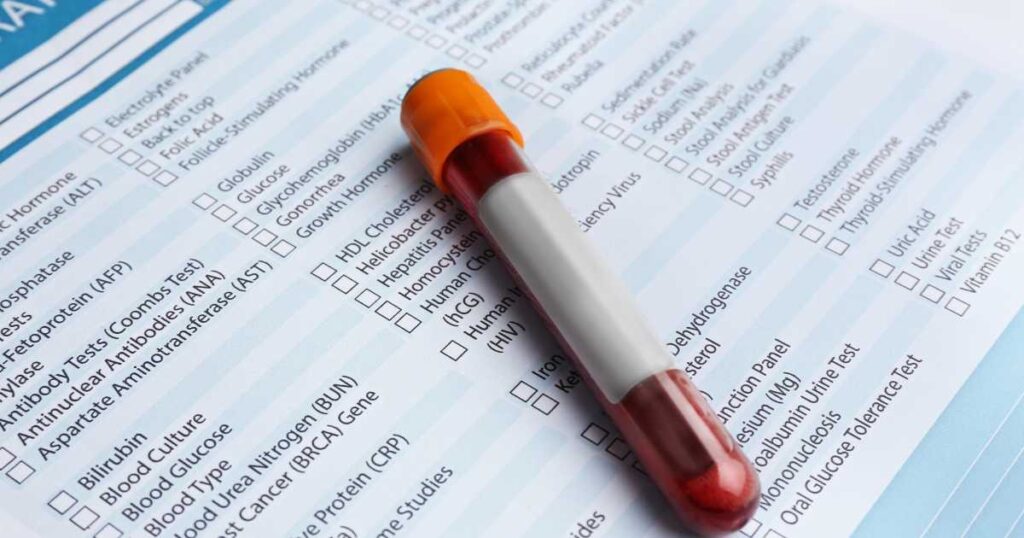 CBC Blood Test: A Complete Guide for Non-Physicians [2025]