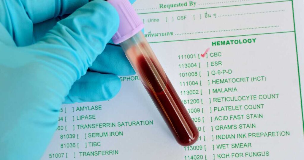 CBC Blood Test: A Complete Guide for Non-Physicians [2025]