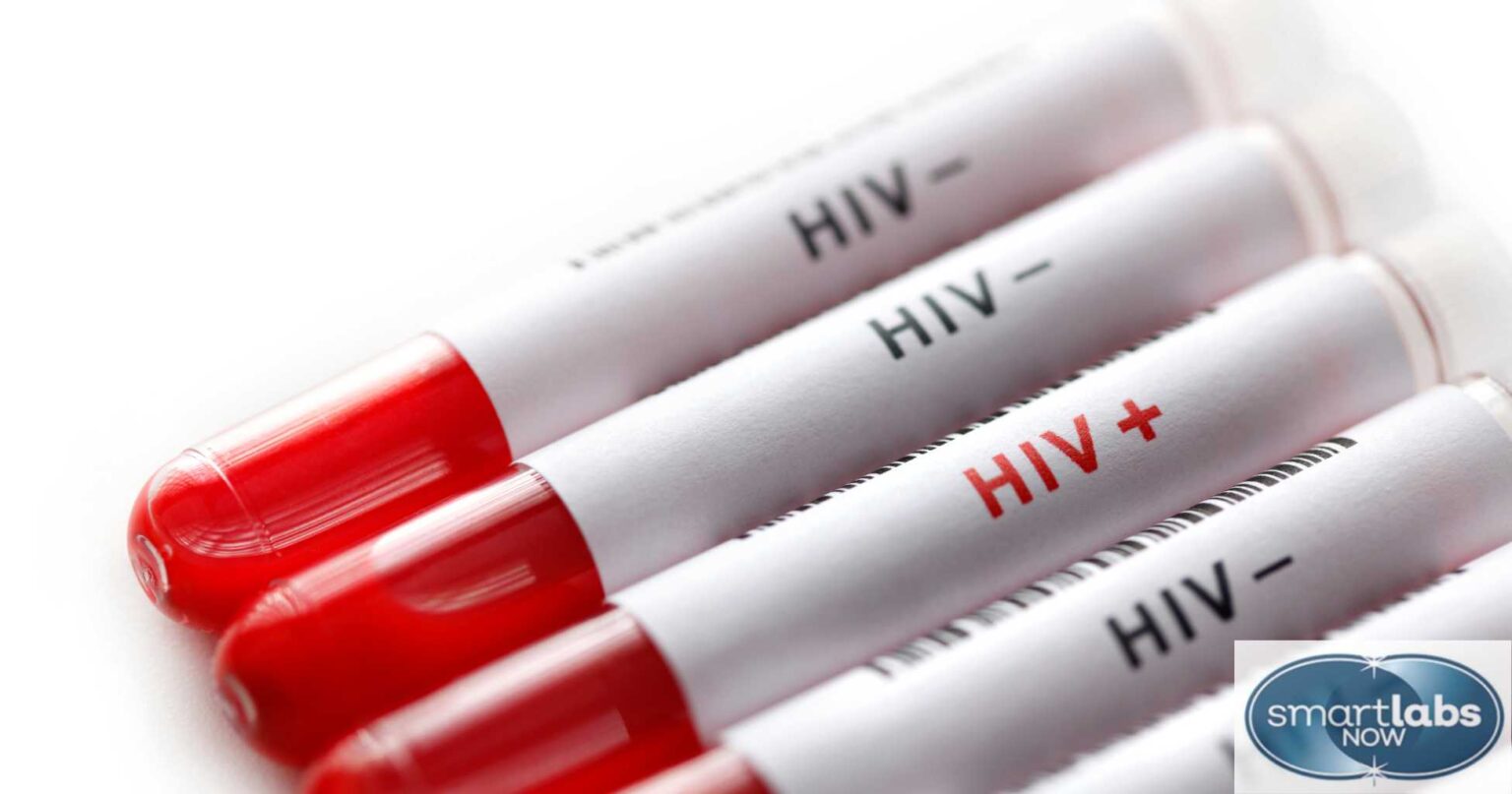 Signs of HIV in CBC Test: Key Indicators