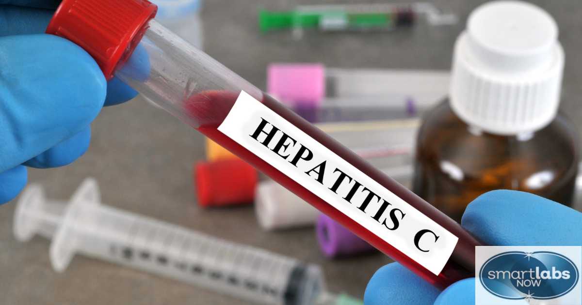 Hepatitis C Testing: Key Facts and Insights
