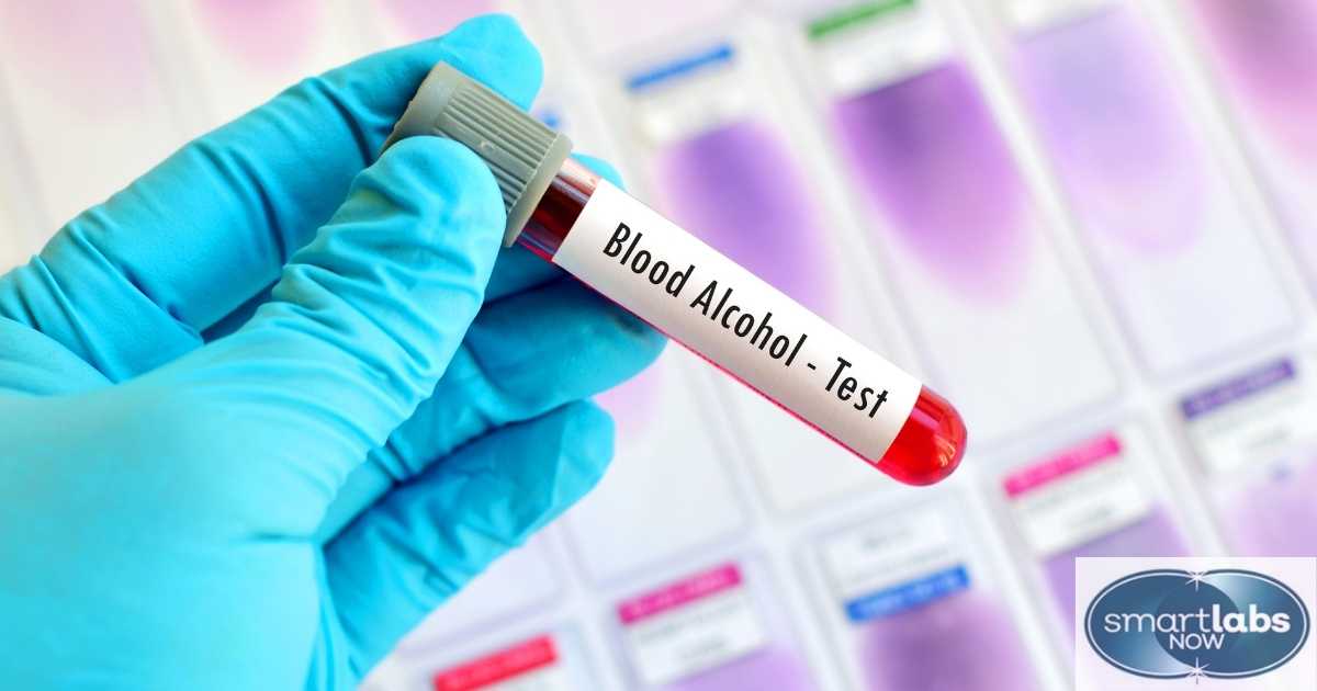 What is a PEth Test? Essential Information