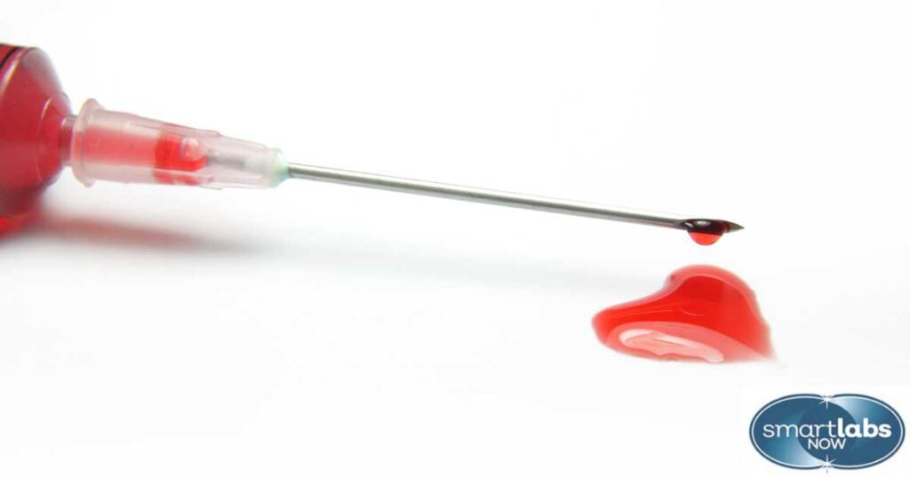 RDW Blood Test Explained: What You Need to Know