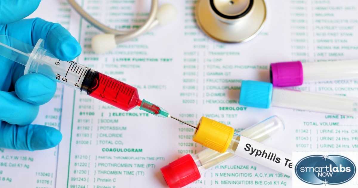 RPR Test Explained: Purpose and Procedure