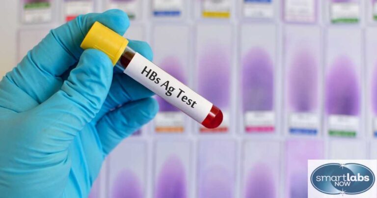 Hepatitis B Surface Antigen (HBsAg) Test - Portland|Oregon