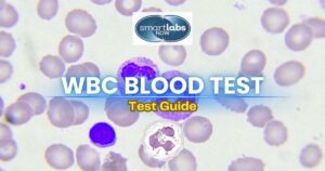 WBC Blood Test Explained: A Quick Guide