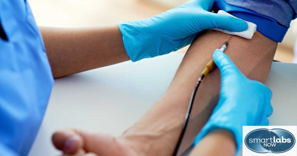 Platelet Count (PLT) Test - Portland|Oregon