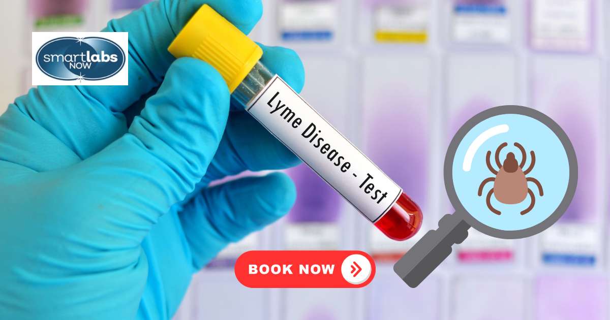 Lyme Disease Test - Portland | Oregon - Smart Labs Now | Lab Testing ...
