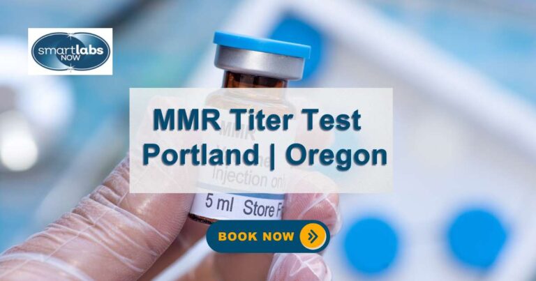 MMR Titer Test - Portland | Oregon - Smart Labs Now | Lab Testing ...